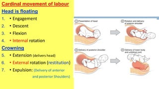 Shoulder dystocia dr Ahmed Walid Anwar Morad | PPTX | Pregnancy ...