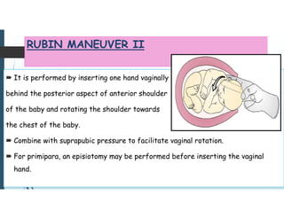 Presentation on shoulder dystocia Powerpoint | PDF