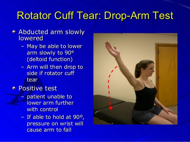 drop-arm-sign-painful-arc-sign