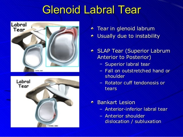 Shoulder exam studentsandresidents