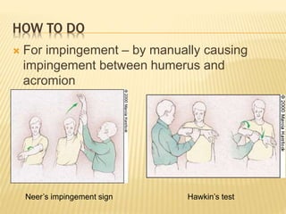 Shoulder examination | PPTX