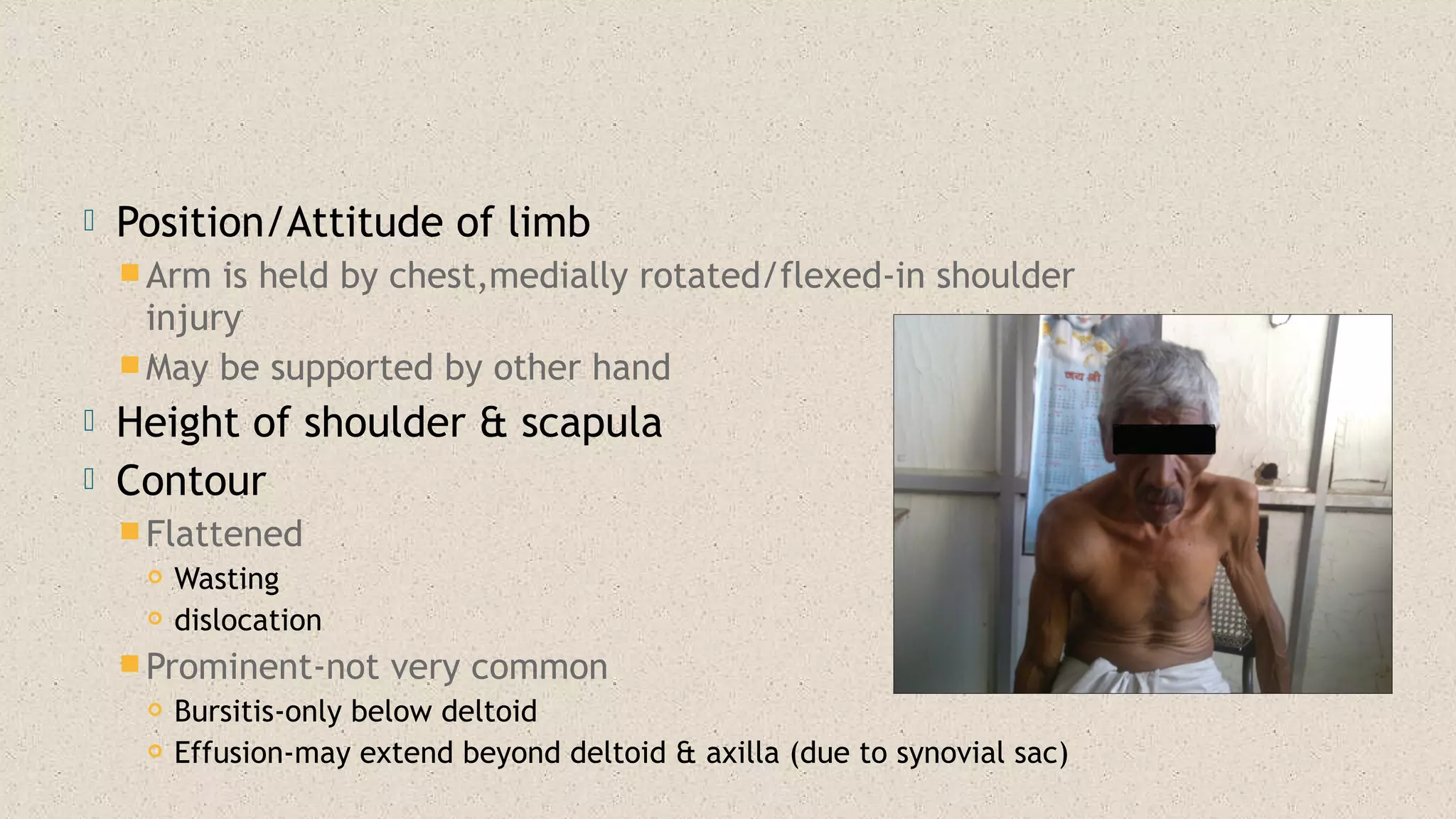 Shoulder examination | PPT