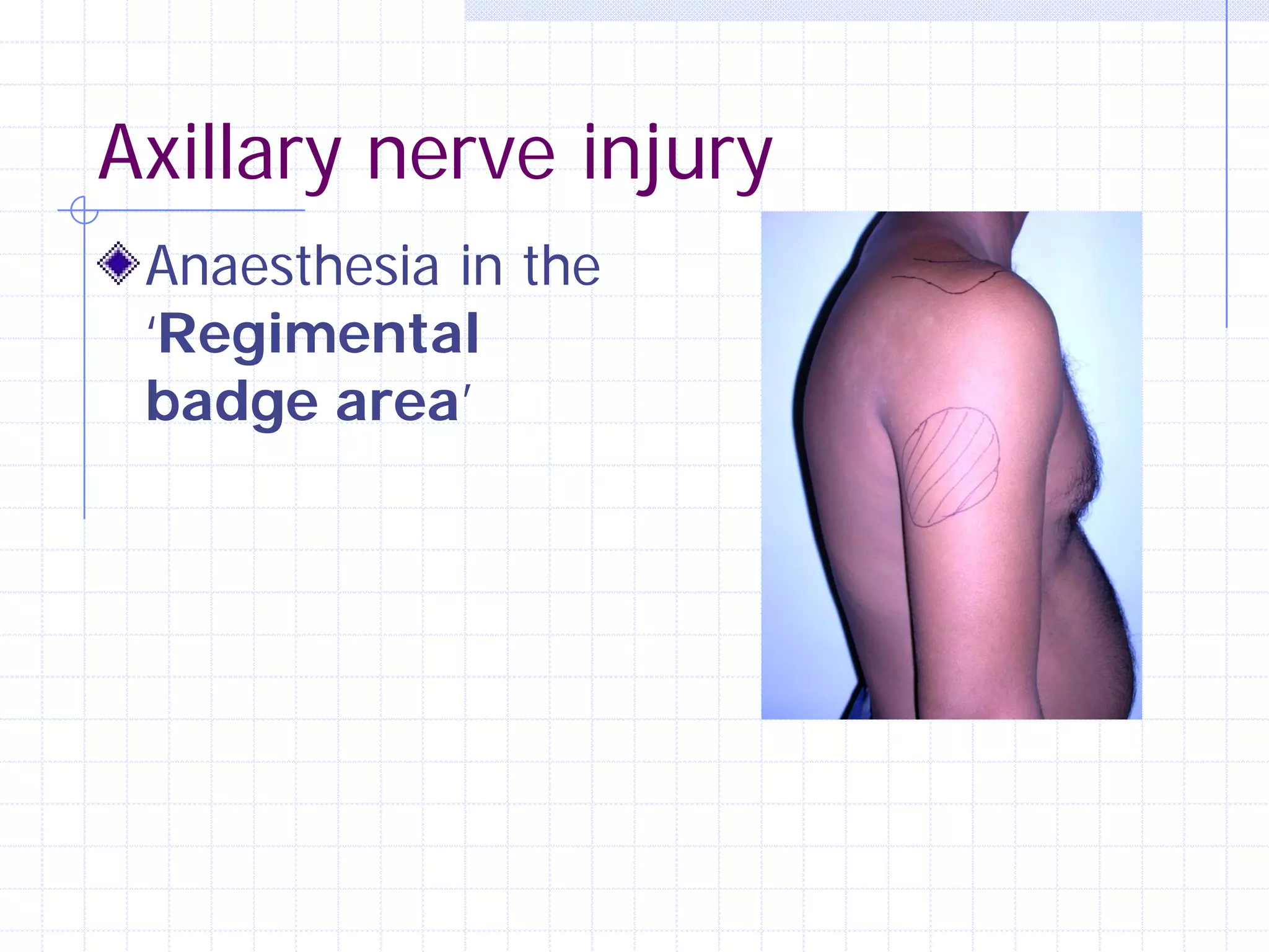 Shoulder examination | PDF