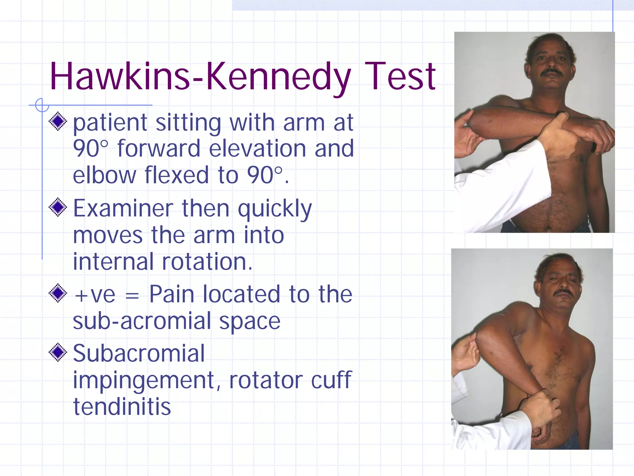 Shoulder examination | PDF