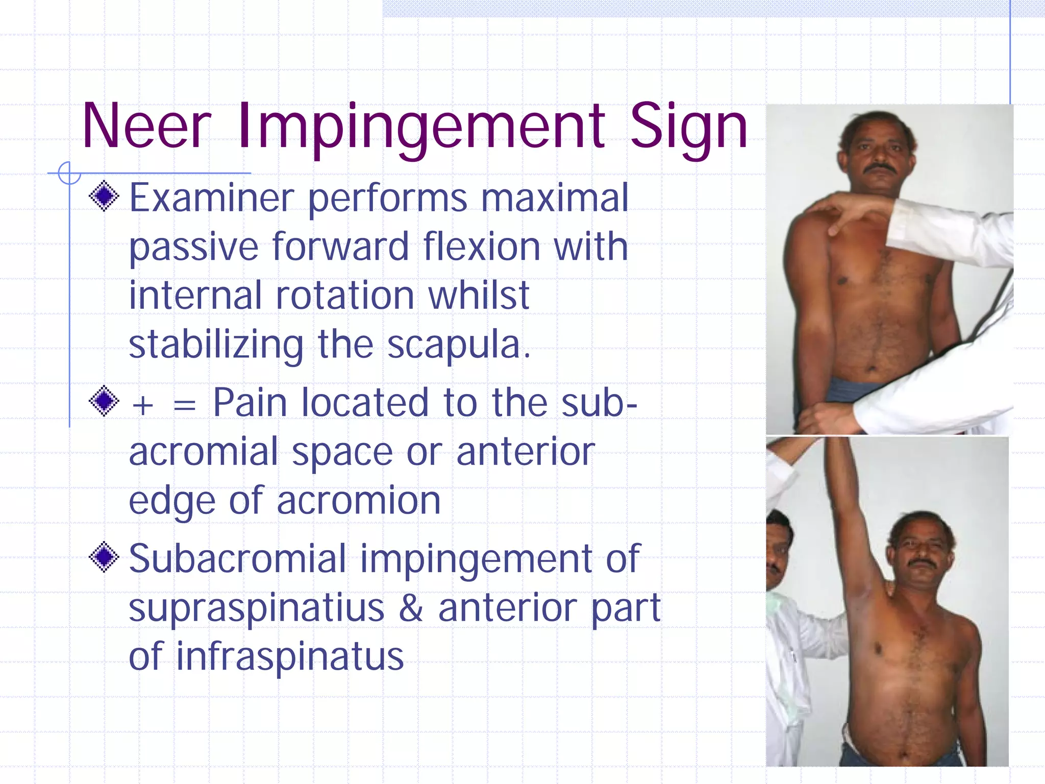 Shoulder examination | PDF