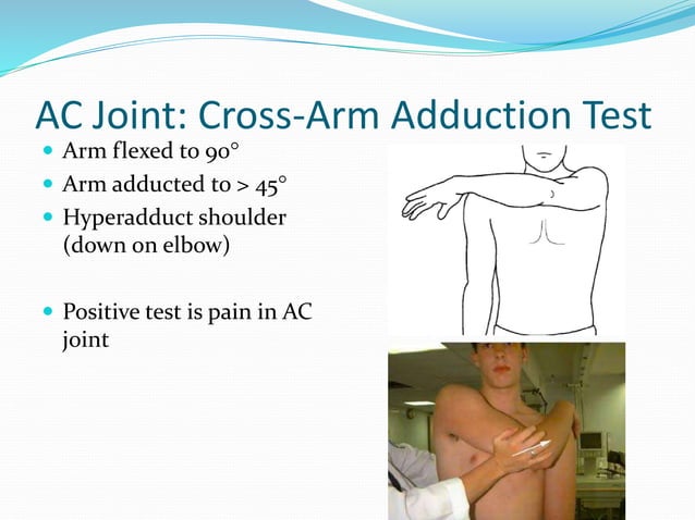 Shoulder examination ppt | PPTX | Death, Injury, or Military Conflict ...