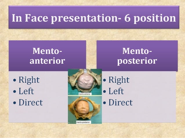 Shoulder,face ,braw,,compound presention for undergraduate
