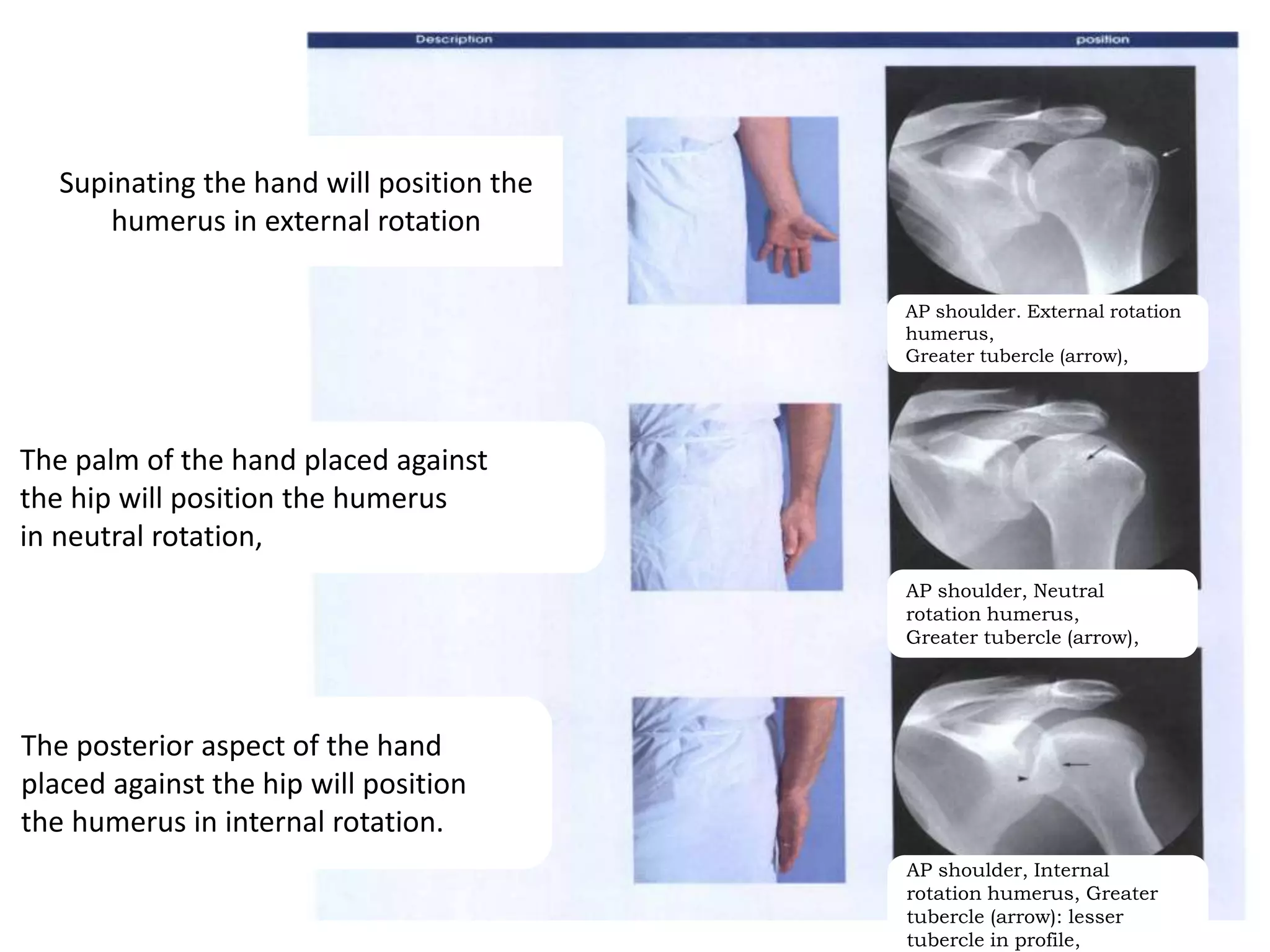 Shoulder girdle presentation | PPTX
