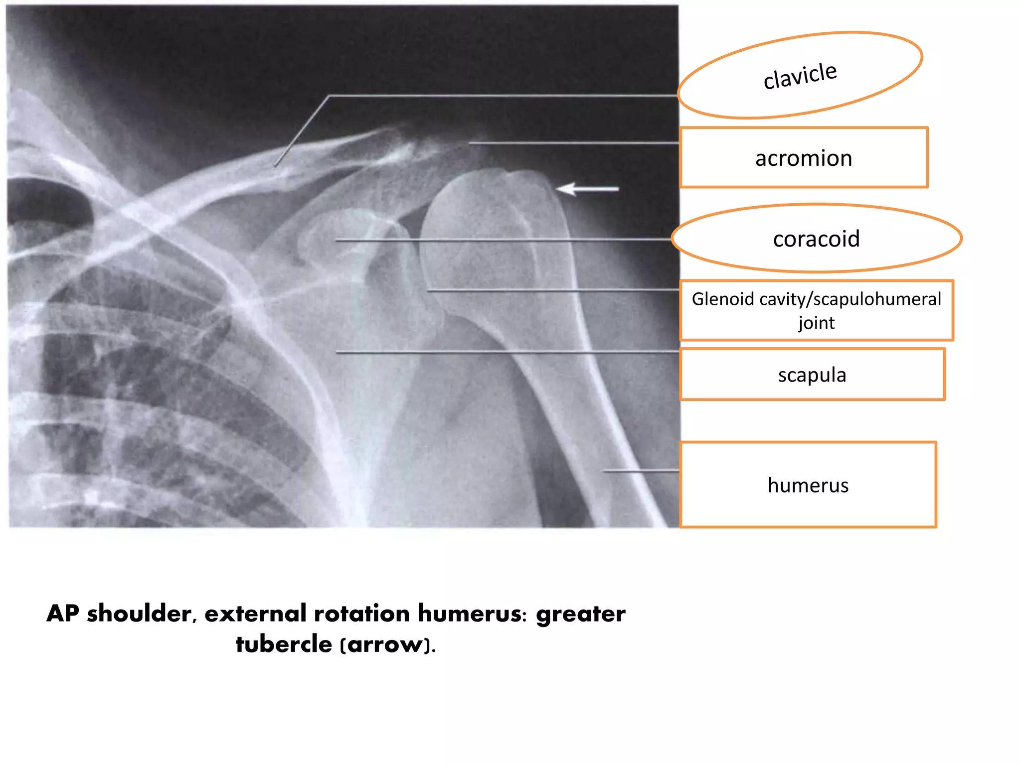 Shoulder girdle presentation | PPTX