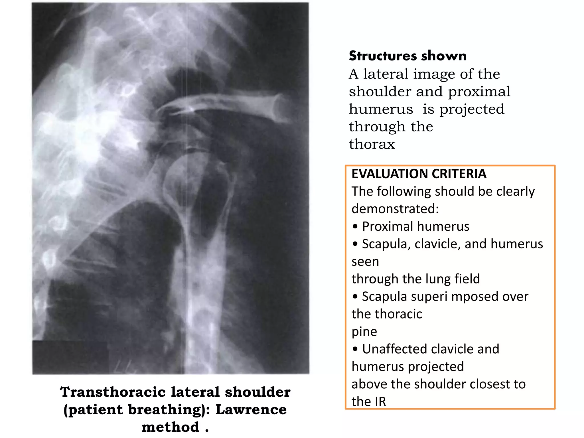 Shoulder girdle presentation | PPTX