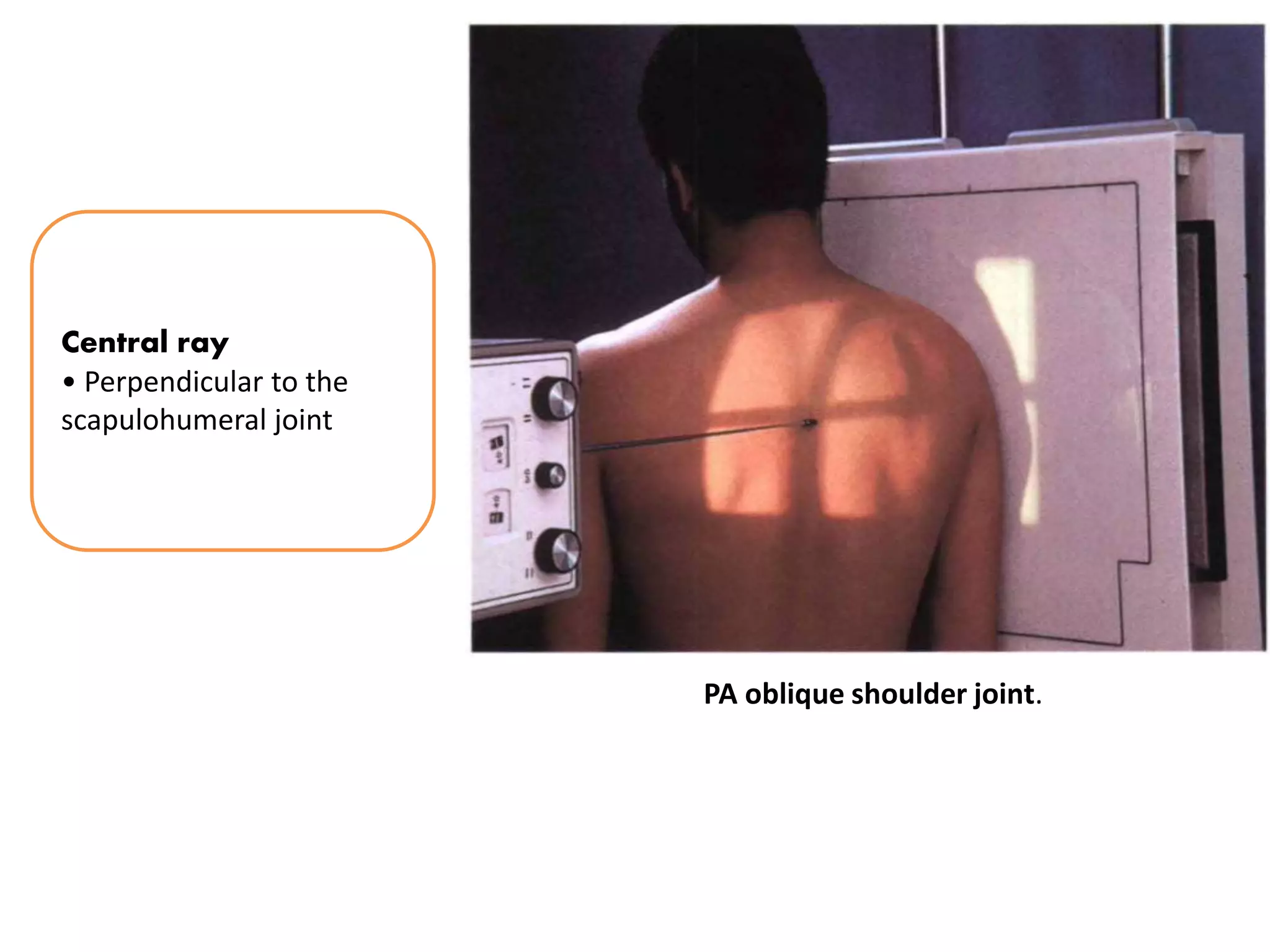 Shoulder girdle presentation | PPTX