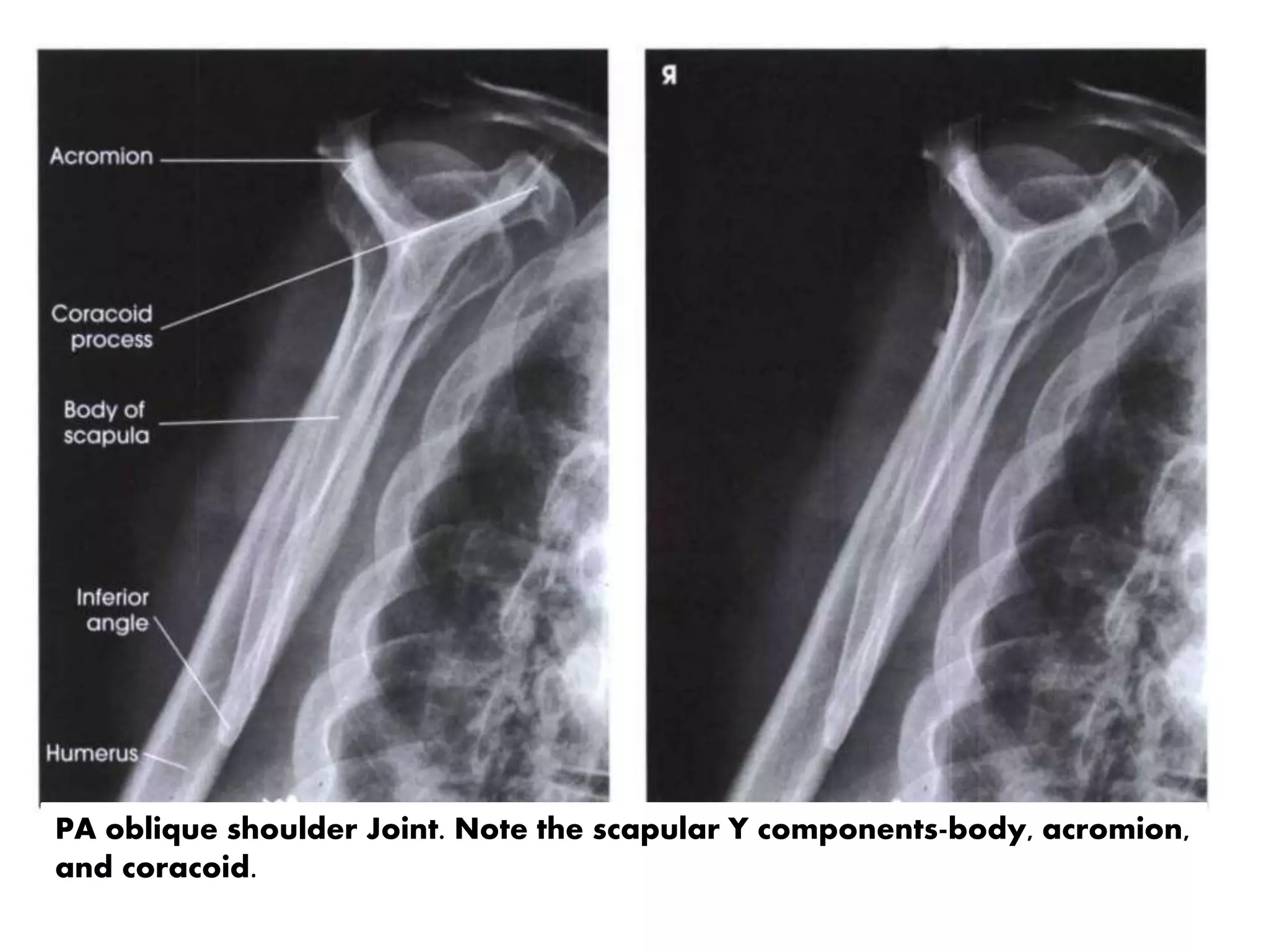 Shoulder girdle presentation | PPTX