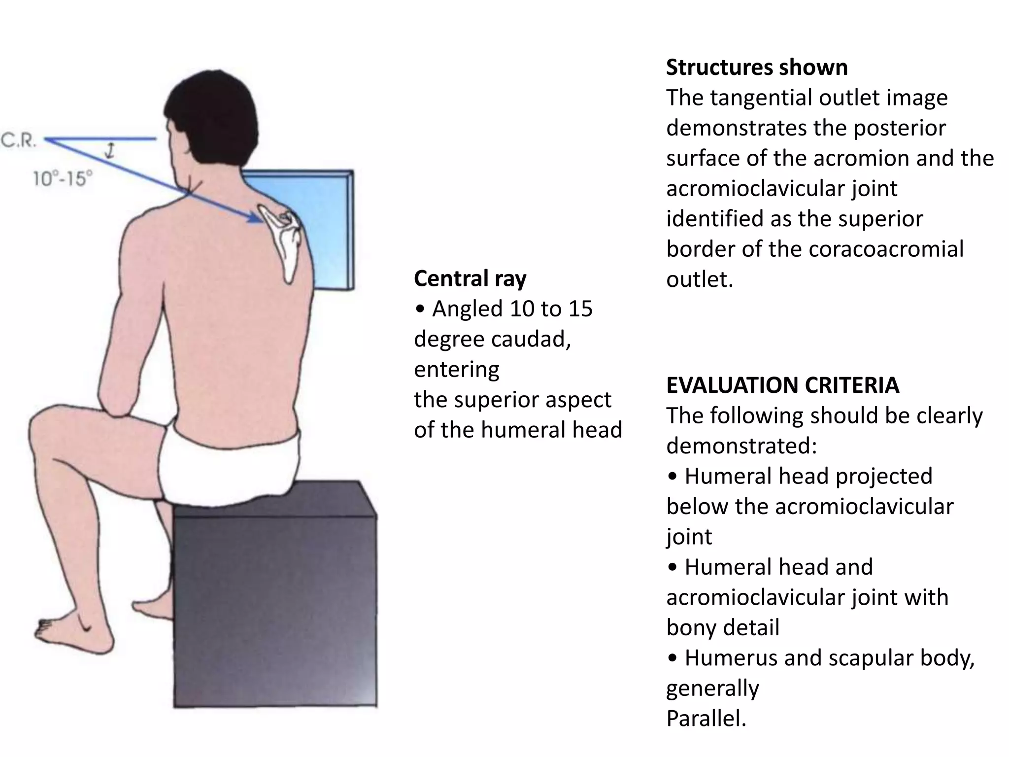 Shoulder girdle presentation | PPTX