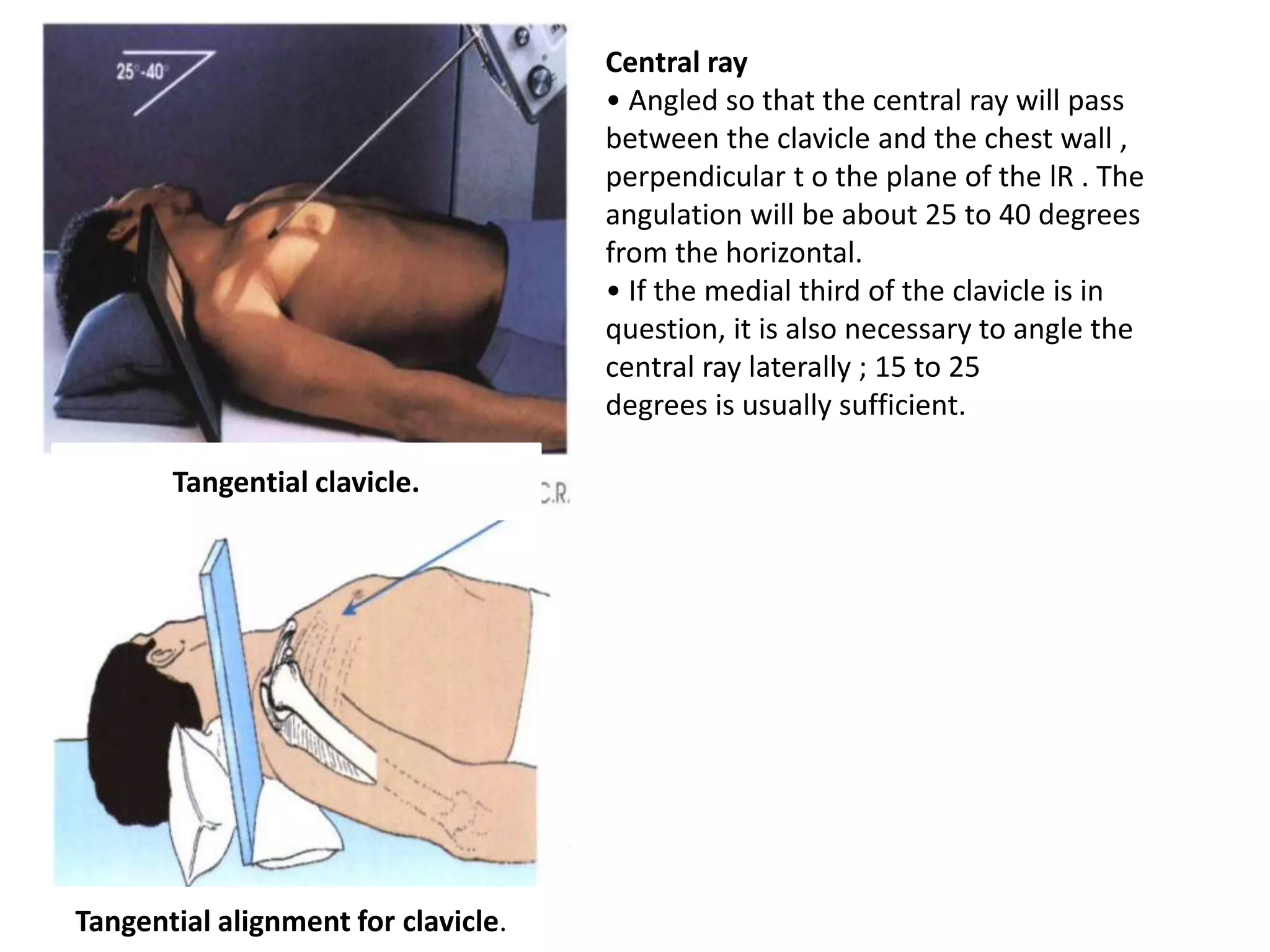 Shoulder girdle presentation | PPTX