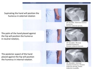 Shoulder girdle presentation | PPTX