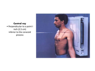 Shoulder girdle presentation | PPTX