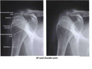 Shoulder girdle presentation | PPTX