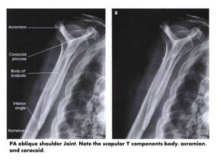 Shoulder girdle presentation | PPTX