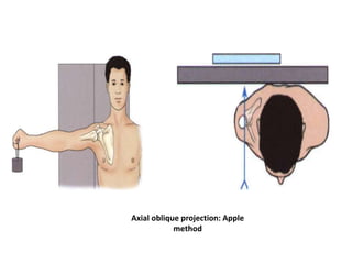 Shoulder girdle presentation | PPTX