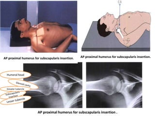 Shoulder girdle presentation | PPTX