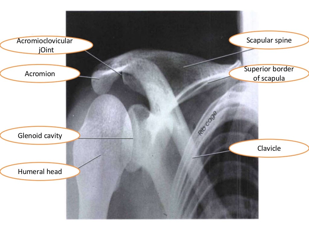 Shoulder girdle presentation