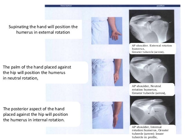 Shoulder girdle presentation