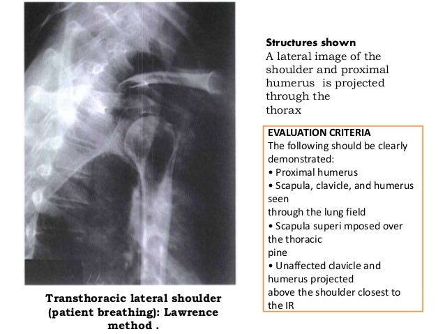Shoulder girdle presentation