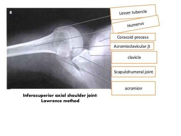 Shoulder girdle presentation
