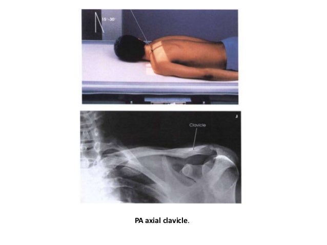 Shoulder girdle presentation