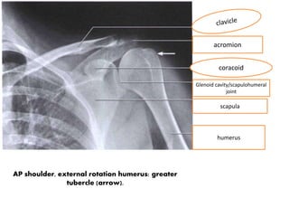 External Rotation Shoulder Xray