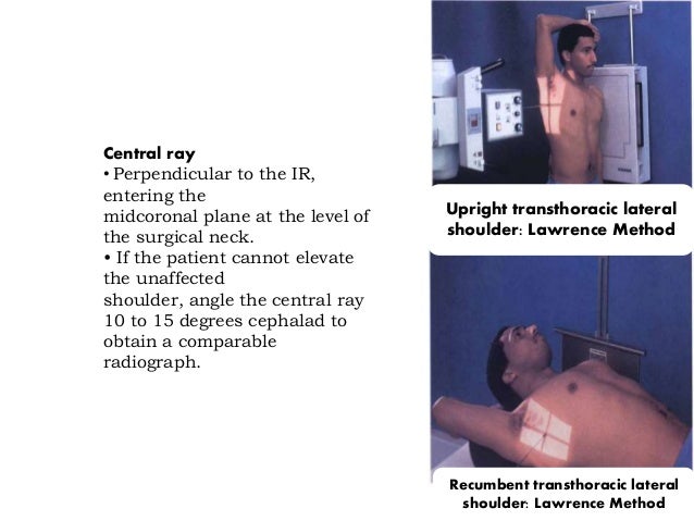 Shoulder girdle presentation