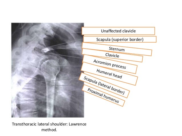 Shoulder girdle presentation