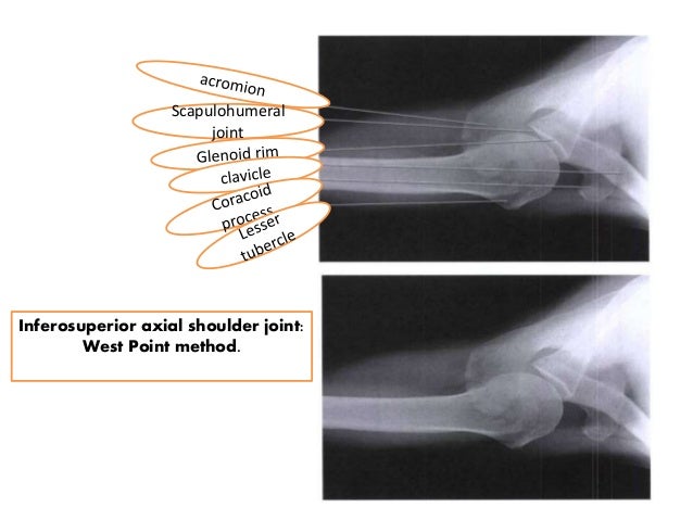 Shoulder girdle presentation