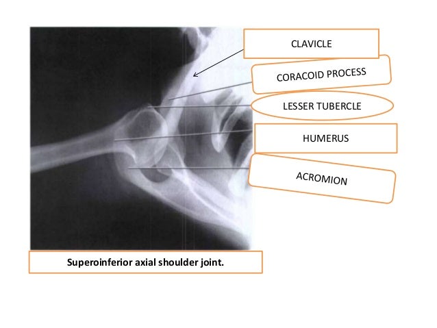 Shoulder girdle presentation