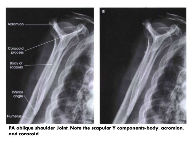 Shoulder girdle presentation