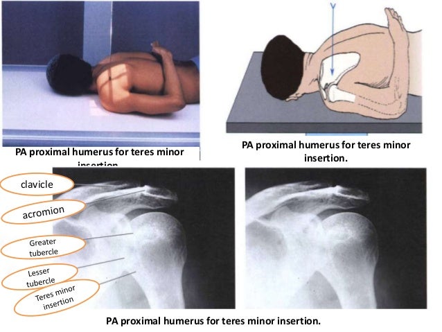 Shoulder girdle presentation
