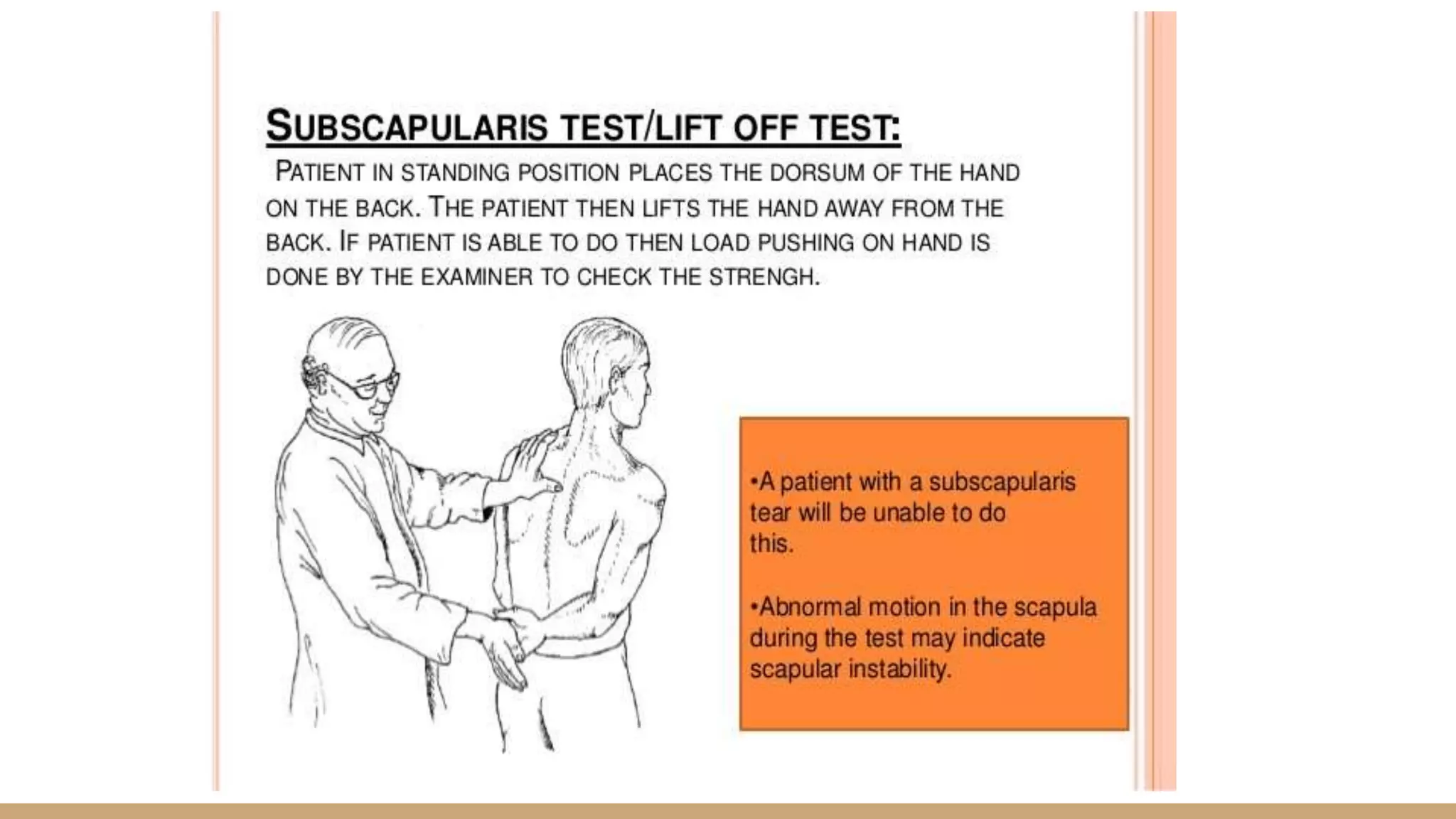 Shoulder impingement syndrome | PPTX