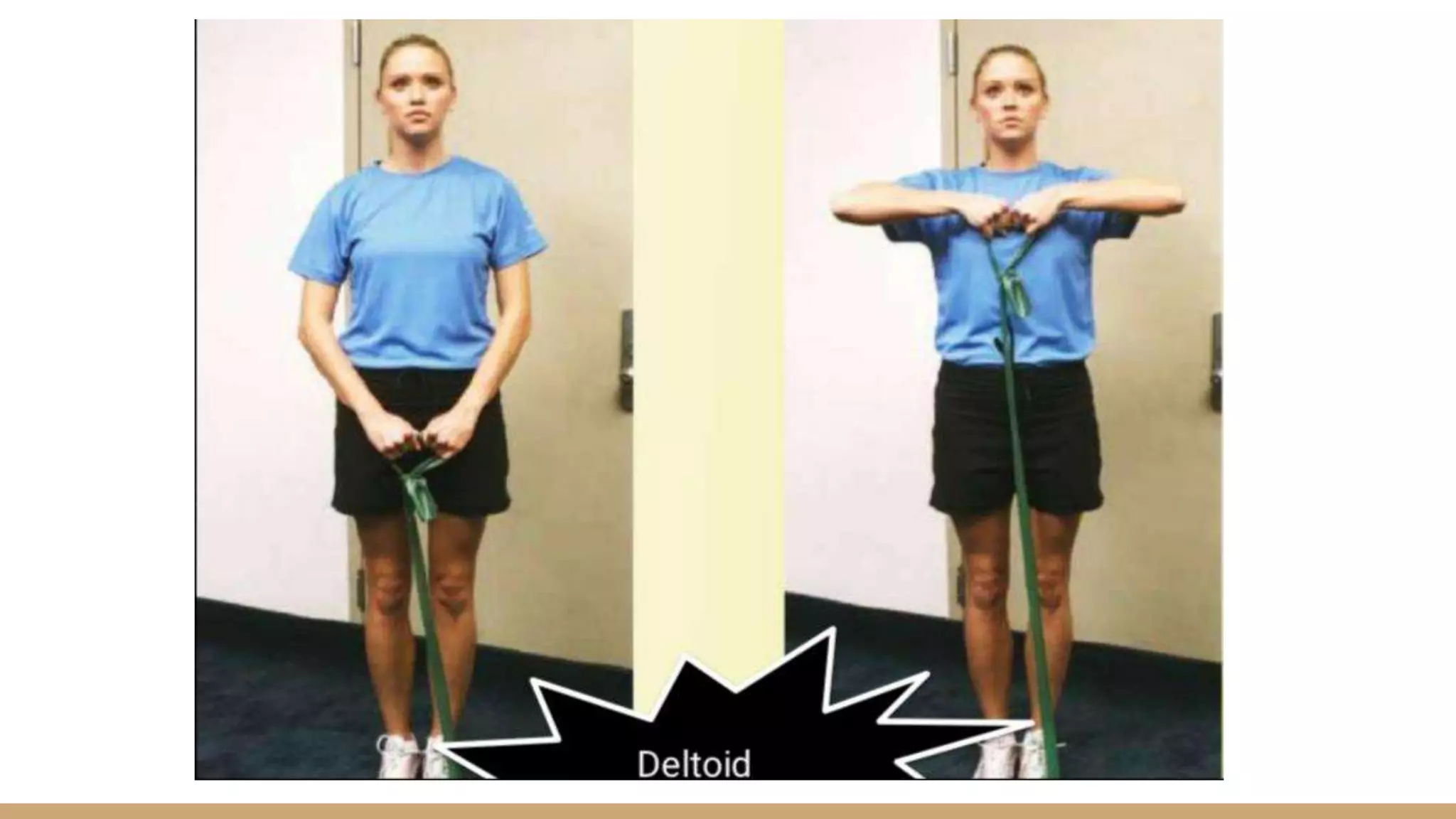 Shoulder impingement syndrome | PPTX