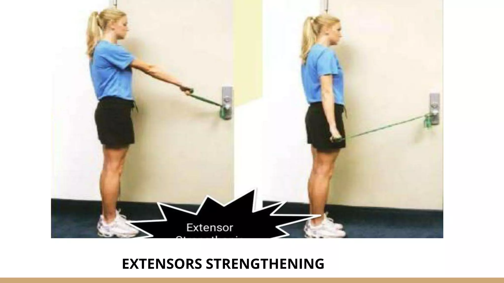 Shoulder impingement syndrome | PPTX