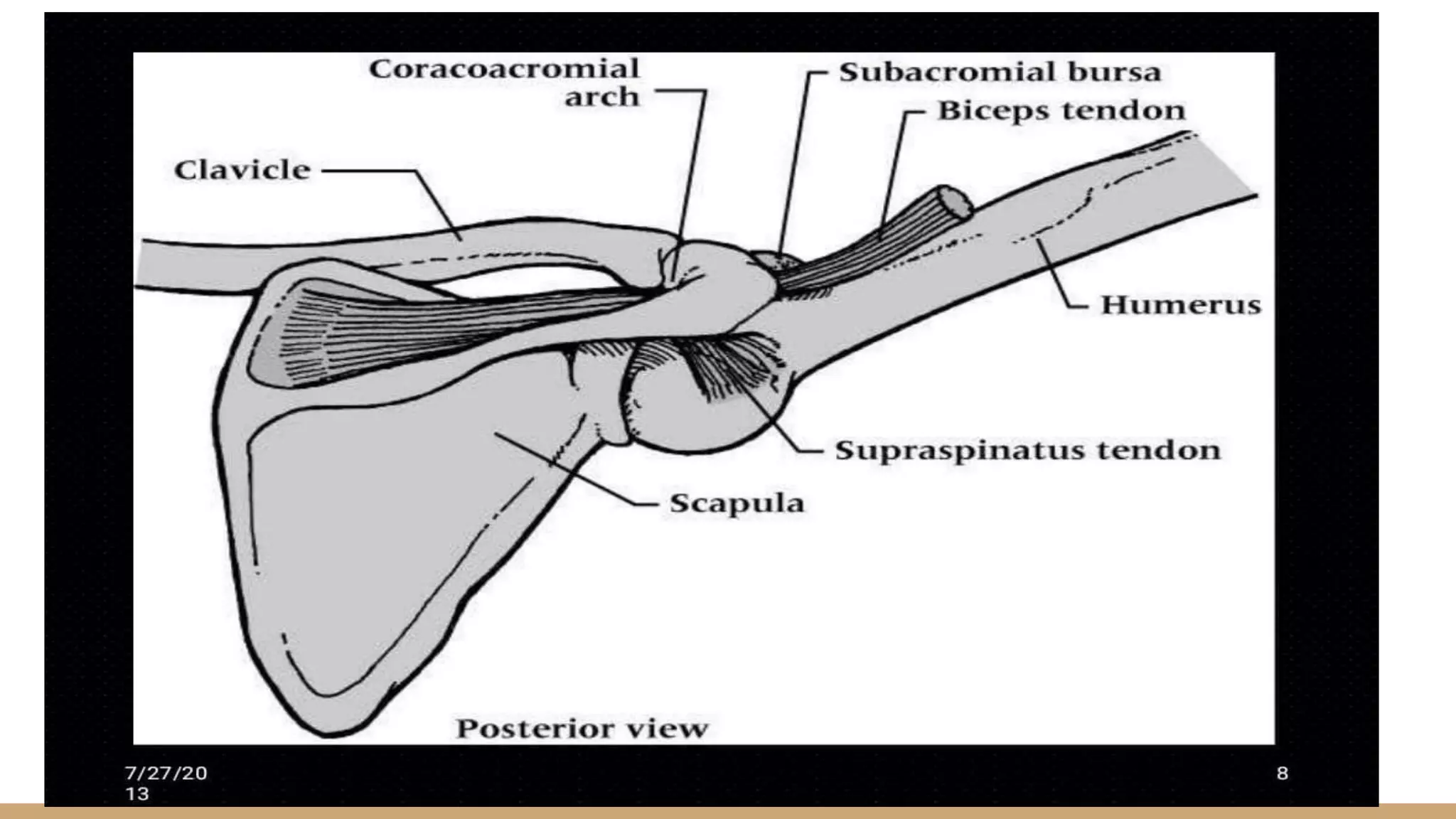 Shoulder impingement syndrome | PPTX