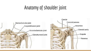 Shoulder impingement syndrome | PPTX