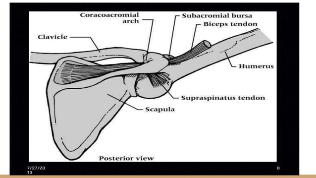 Shoulder impingement syndrome | PPTX