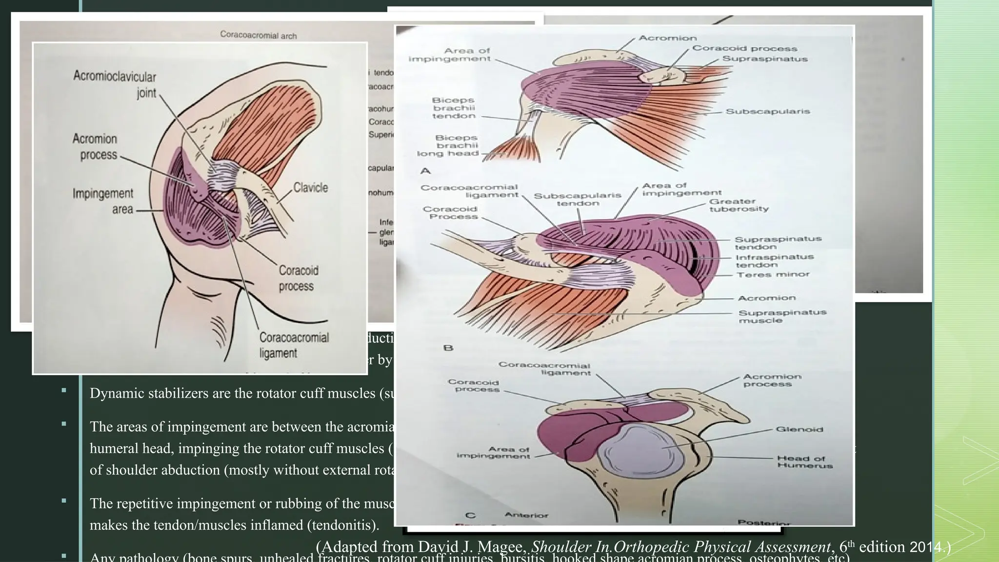 shoulder impingement in sports physiotherapy | PPT