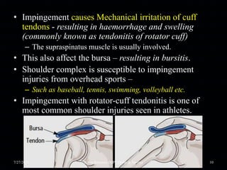 Shoulder impingement syndrome | PPTX