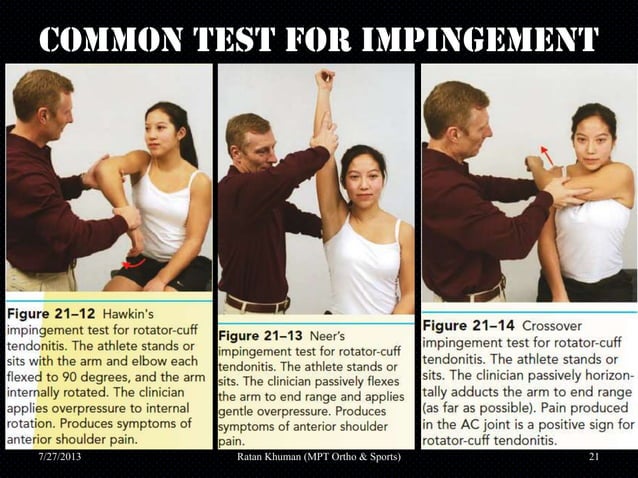 Shoulder impingement syndrome | PPTX