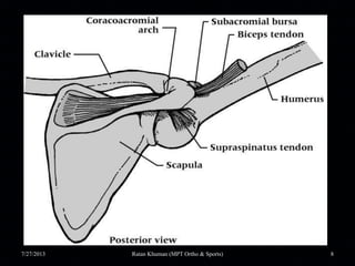 Shoulder impingement syndrome | PPTX