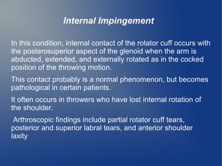 Shoulder impingement syndrome | ODP