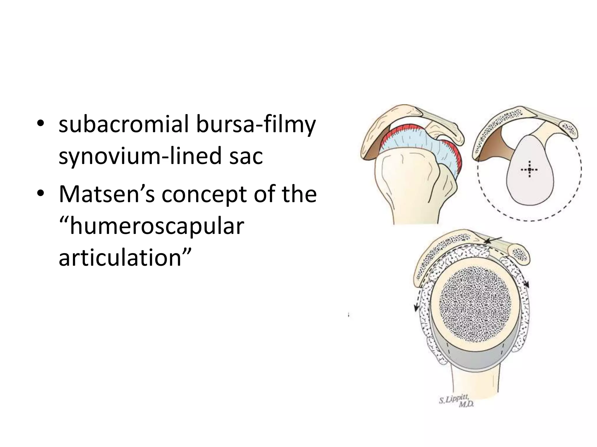 Shoulder impingement syndrome | PPTX