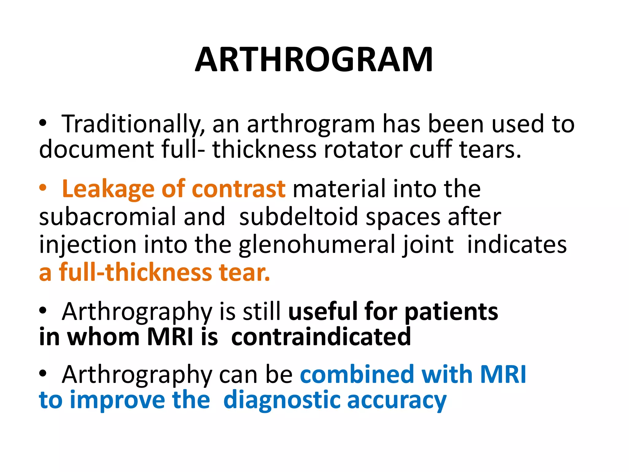 Shoulder impingement syndrome | PPTX