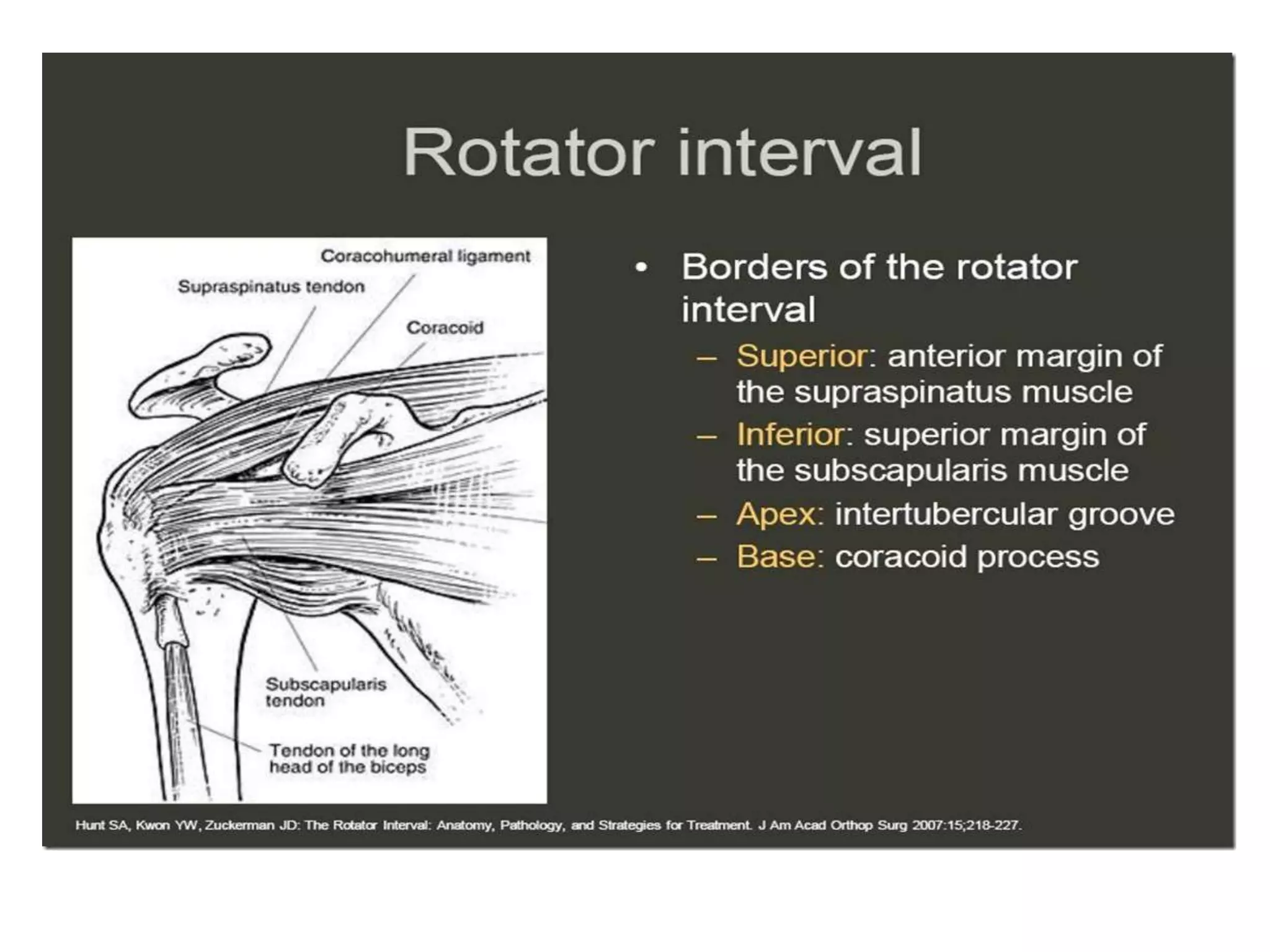 Shoulder impingement syndrome | PPTX